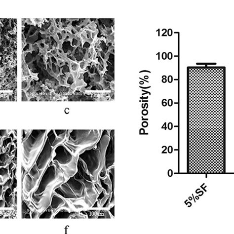 The Hierarchical Microstructure Of The Scaffolds Under Scanning