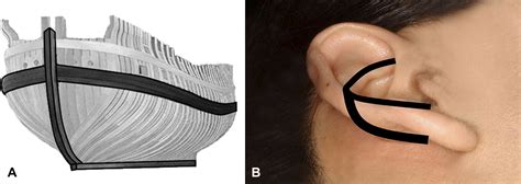 Ear Anatomy Conchal Bowl At Alma Jones Blog