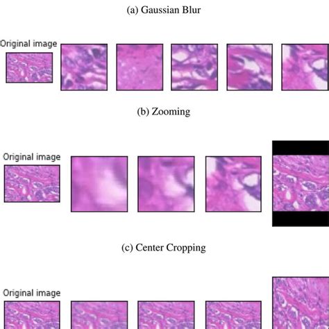 Breast Cancer Dataset Augmentation We Artificially Synthesis Of Download Scientific Diagram