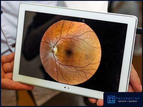 Essential Facts About Optos High Resolution Retinal Imaging