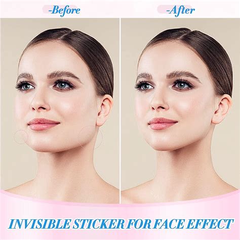 List 96+ Pictures Kinesiology Taping Face Taping Before And After Updated