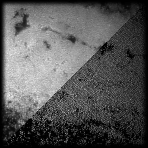 Split Images Showing Diffraction Limited Upper Right And