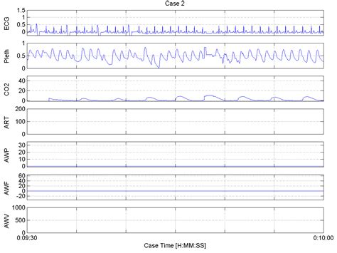 Case Waveform Plots Second Plots