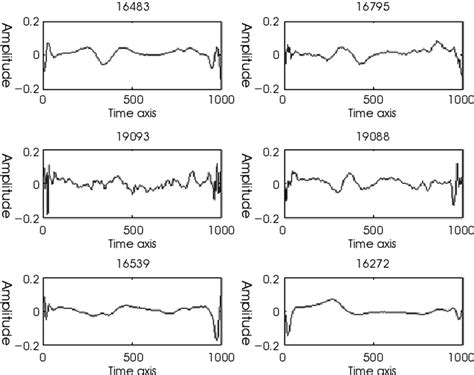 Figure 1 From Development Of Electrocardiogram Identification Algorithm