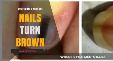 Why Your Nails Darken Causes Concerns And Solutions Explained Nailicy