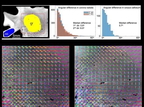 Figure Supplement 3 Quantifying In Plane Angular Differences Between