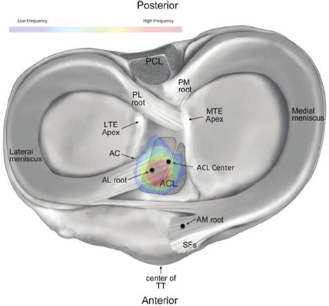 Medial Meniscus Anatomy