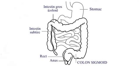 Sigmoidoscopia Ce Presupune și Când E Indicată Cancer360