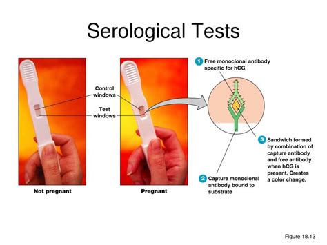 Ppt Enzyme Linked Immunosorbent Assay Direct Elisa Powerpoint