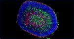 High-resolution transcriptome analysis with long-read RNA sequencing | RNA-Seq Blog
