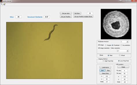 Graphical User Interface Of A Matlab Program That Simulates The Mr Download Scientific Diagram