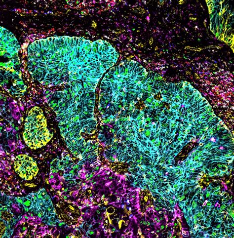 Spatial Proteomics Bostongene