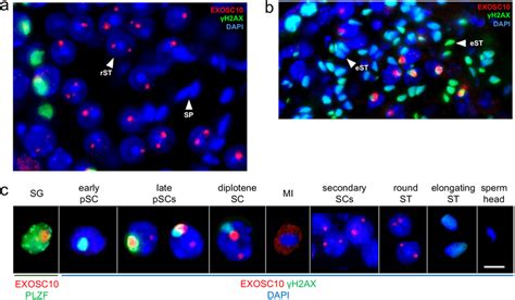Exosc10 Localization During Post Meiotic Germ Cell Differentiation A Download Scientific