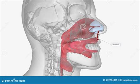 Epistaxis Is A Nosebleed Caused Either By Injury Or Appearing