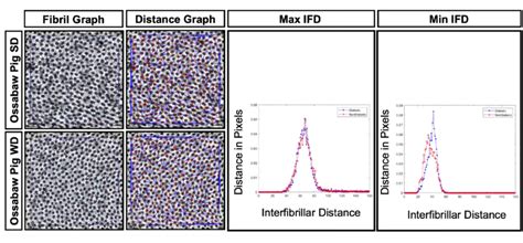 Quantitation Of Transmission Electron Microscopy Of Collagen Fibrils In