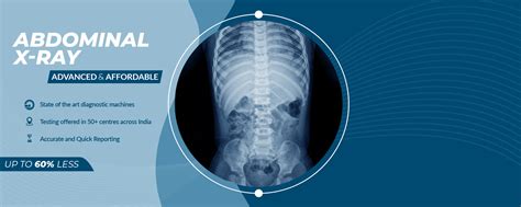 Abdominal X Ray Aarthi Scans And Labs