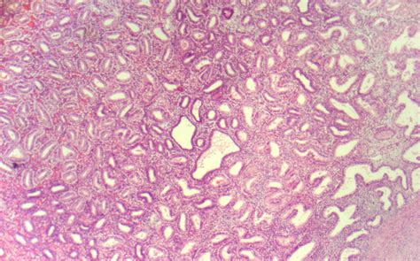 Proliferative Endometrium Histology