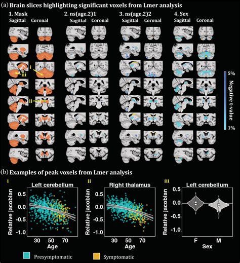 A Brain Slices Of The Brain Highlighting Significant Age Effects From Download Scientific