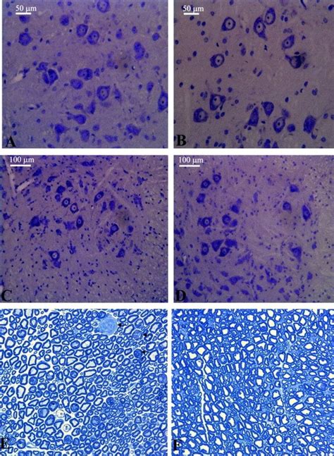 Motor Neuron Cell Bodies And Ventral Roots In Mild Sma Mice Motor Download Scientific Diagram