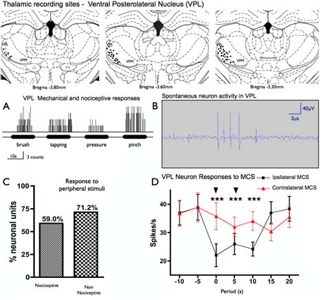 Neuronal Recordings In The Vpl Images In The Top Show The Recording