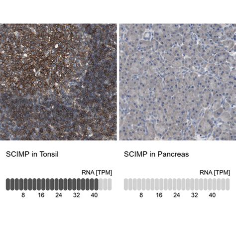 Rabbit Polyclonal Anti Scimp Antibody Buy For Research Highly