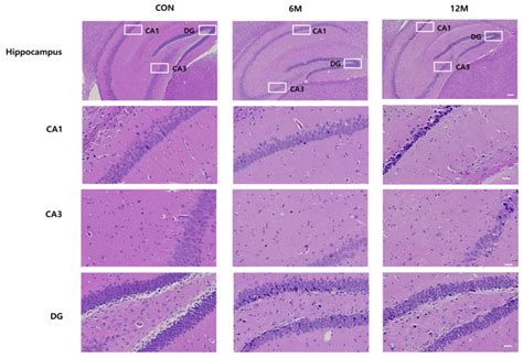Differential Glial Response And Neurodegenerative Patterns In Ca1 Ca3