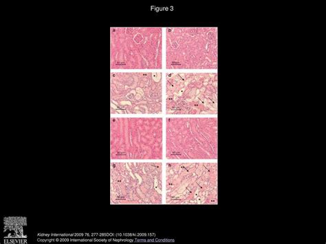 Volume 76 Issue 3 Pages August 2009 Ppt Download