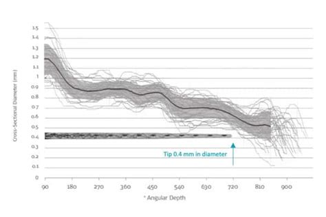 9 Reasons Why Cochlear Implant Electrodes Matter Med El Professionals