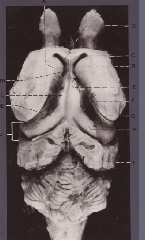Diagram Of Neuro 4 Quizlet