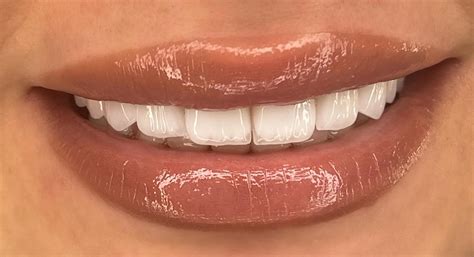 Doctor Hussein Ajami Dentist Dr Hussein Ajami • Instagram Photos