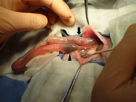 Colonic Obstructive Foreign Body In Case 2 The Bowel Is Dilated With