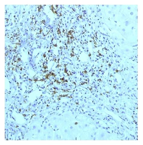Representative Microphotographs Of Cd20 Marker By Immunohistochemistry Download Scientific