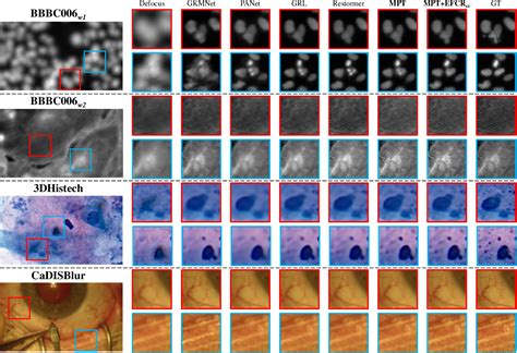 Figure 1 From A Unified Framework For Microscopy Defocus Deblur With