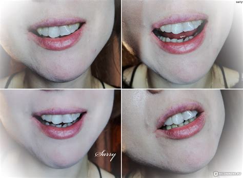 Виниры Aliexpress set for whitening teeth and upper and lower veneers ...