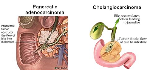 Examples Of Malignant Strictures Download Scientific Diagram