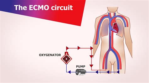 Ecmo Circuit