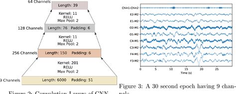 Sleeper Interpretable Sleep Staging Via Prototypes From Expert Rules