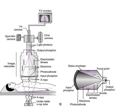 Annotated Schematic Of An X Ray Machine