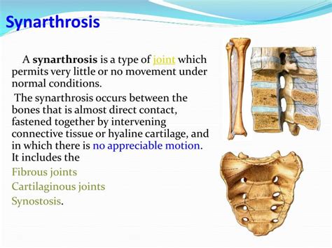 Ppt Arthrology And Joints Of Bones Of Trunk Powerpoint Presentation Id 2050728