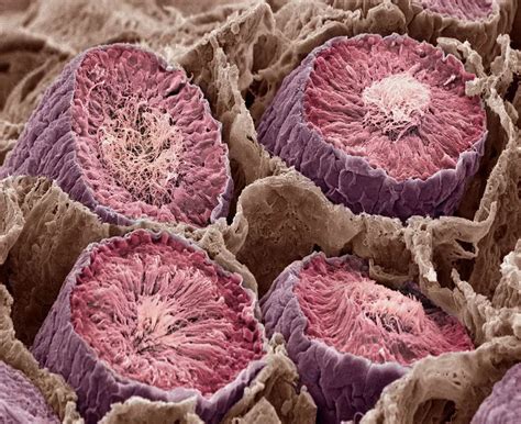 Testicular Sperm Extraction Tese And Microtese Urologist And Andrology Laboratory Located In