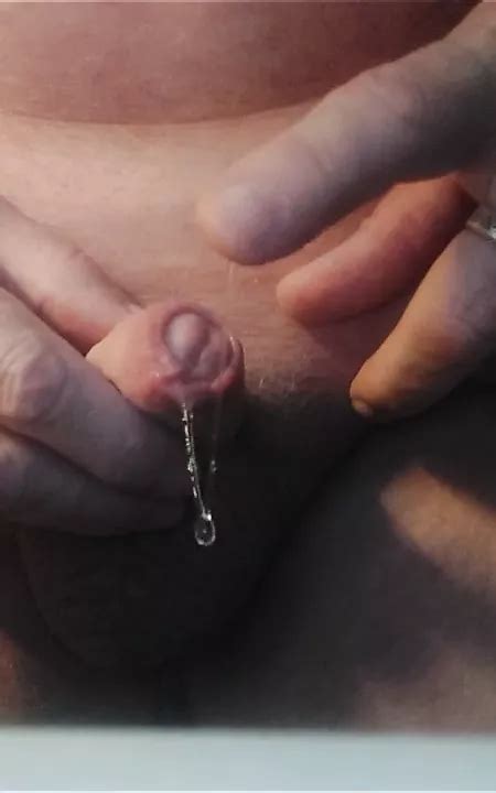 Uncut Dick Dripping Xhamster