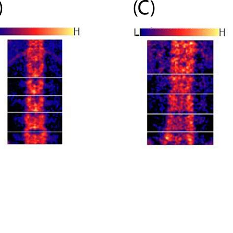 A Protein Microarray Results Of No10 As Patient B Flow Pattern Of Download Scientific
