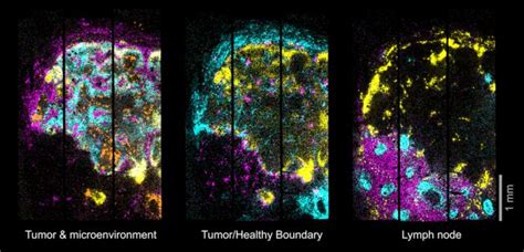 Spatial Transcriptomics Platform Promises Low Cost High Res 3d Mapping