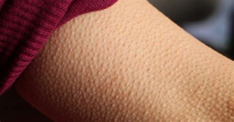If Music Gives You Goosebumps Heres What It May Say About Your Brain
