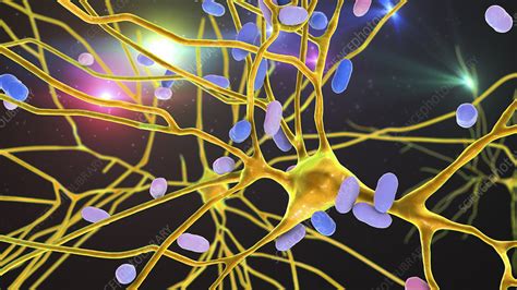 Bacterial Encephalitis Illustration Stock Image F0307558