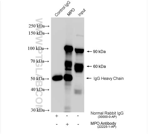 Mpo Antibody 22225 1 Ap Proteintech