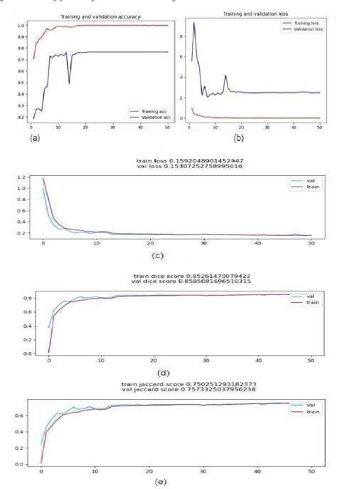 Figure 5 From Automated Brain Tumor Diagnosis And Localization Using Cnn And U Net 3d A