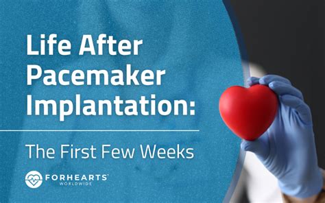 The First Few Weeks After Pacemaker Implantation
