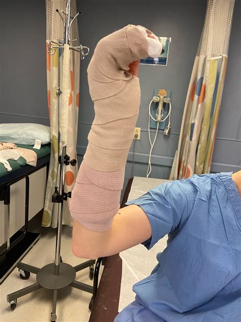 Hcorp Ulnar Gutter Splint