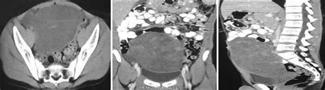 Indian Journal Of Cancer